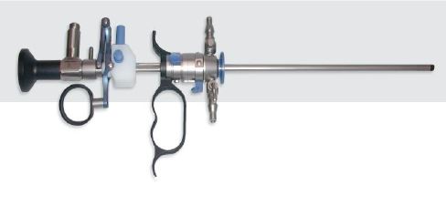 Gubbini Mini Hystero-Resectoscope – Hysteroscopy Newsletter