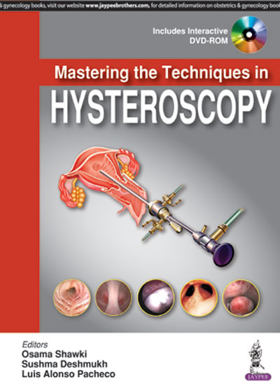 Mastering the Techniques in Hysteroscopy – Hysteroscopy Newsletter